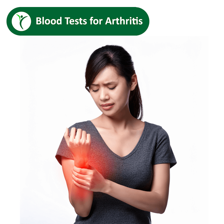 Blood Tests for Arthritis | Diagnose Joint Pain & Inflammation – AIS ...