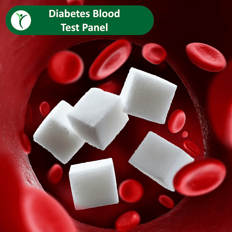 Diabetes Blood Test Panel | Check Glucose, HbA1c & Insulin – AIS Health ...