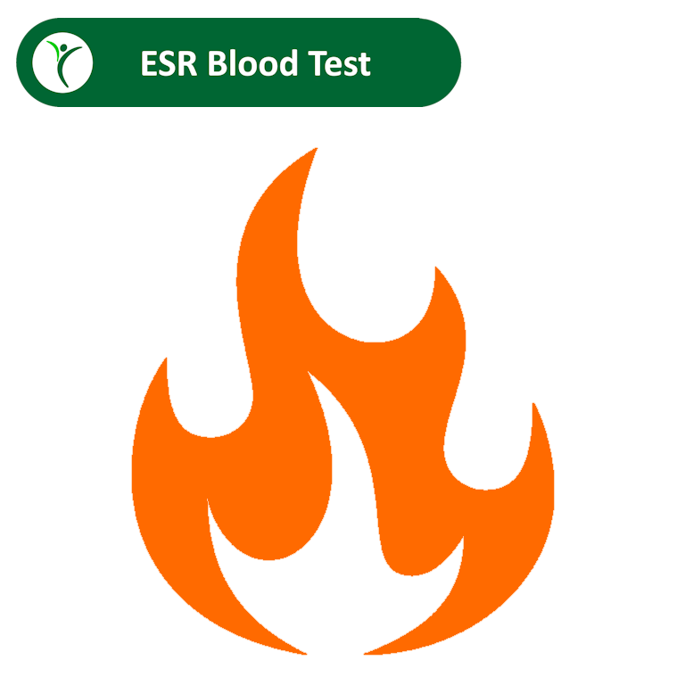 ESR Blood Test | Inflammation & Infection Marker – AIS Health Check