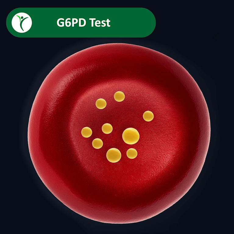 G6PD Test | Check Risk of Haemolytic Anaemia – AIS Health Check