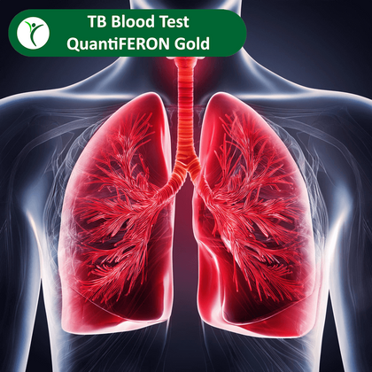 TB Blood Test - QuantiFERON Gold | Tuberculosis Screening – AIS Health ...