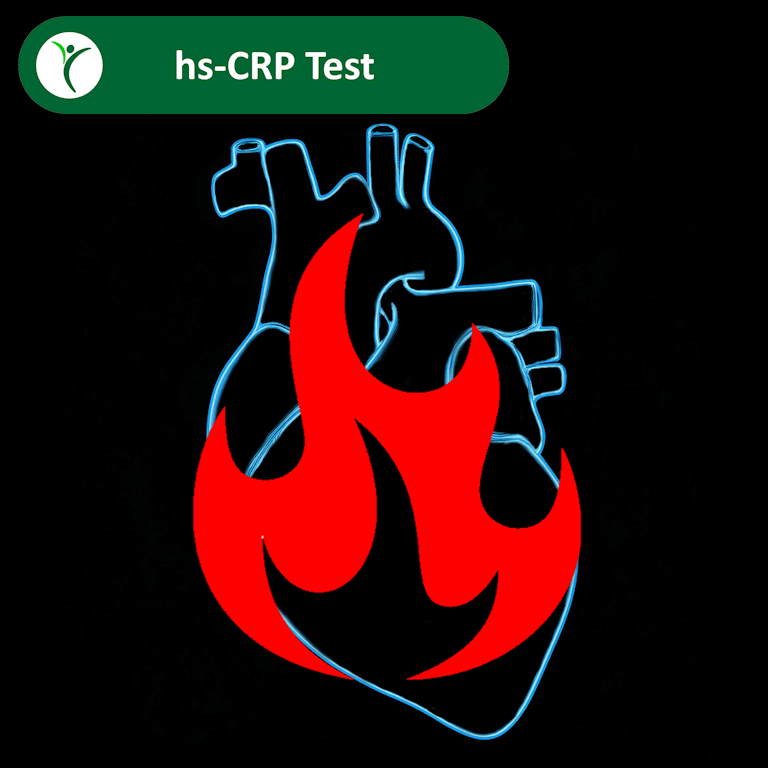 hs-CRP Blood Test | Inflammation Marker for Heart Disease Risk – AIS ...